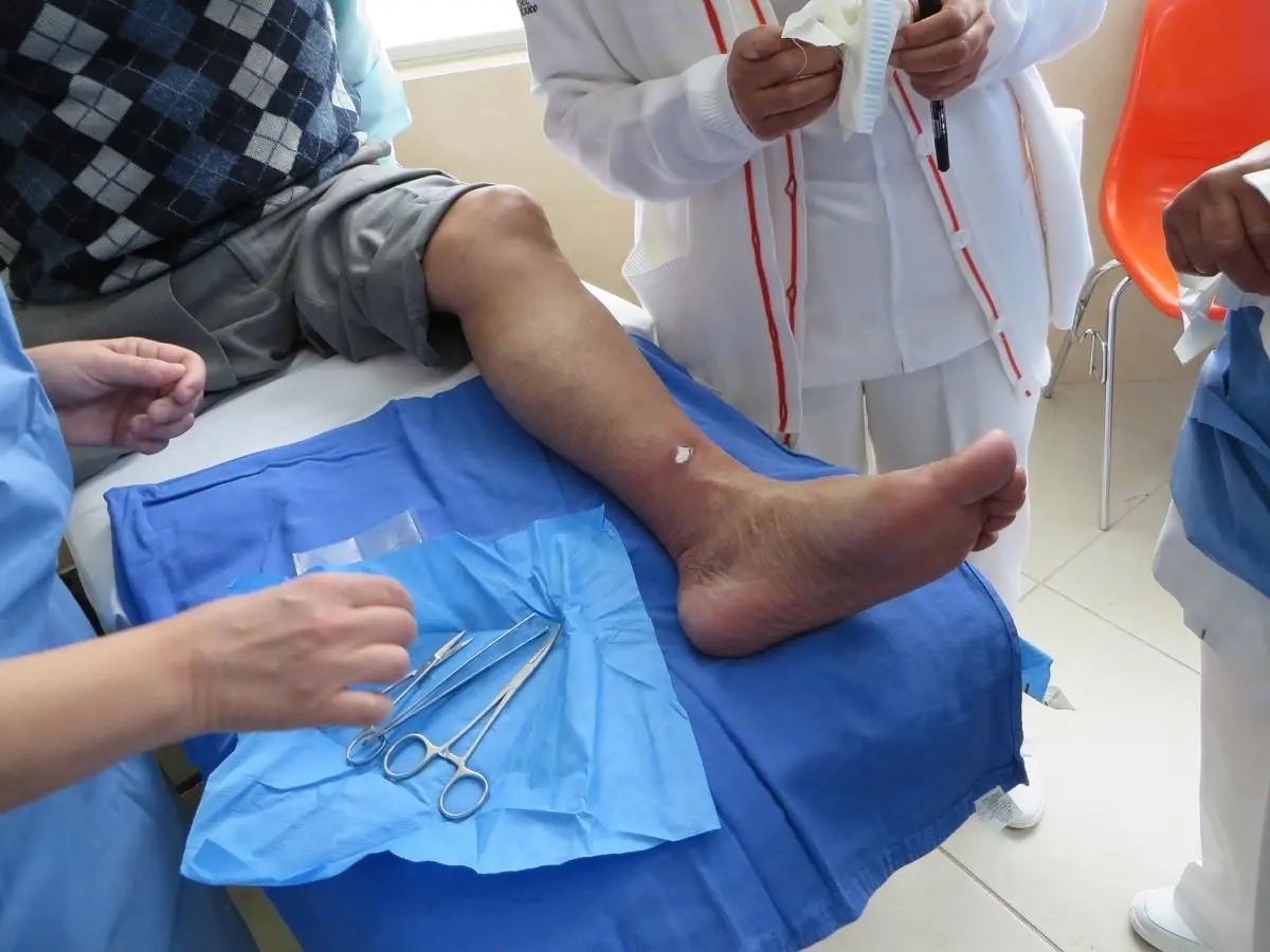 Curacion Avanzada - Heridas Complejas | Curacare